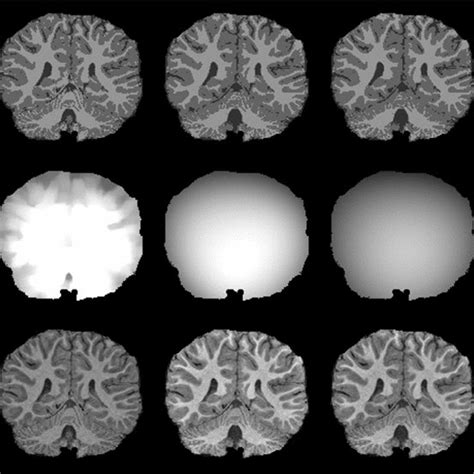 3d Segmentation Results Of A T1 Weighted Clinical 3d Brain Mr Image Download Scientific