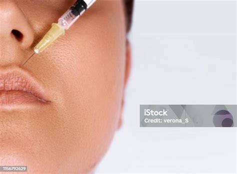 입술 확대에 절차의 클로즈업 아름 다운 젊은 여자 입 수신 히알루 론산 주사 섹시한 여성 입술입니다 미용 치료 개념에 대한 스톡