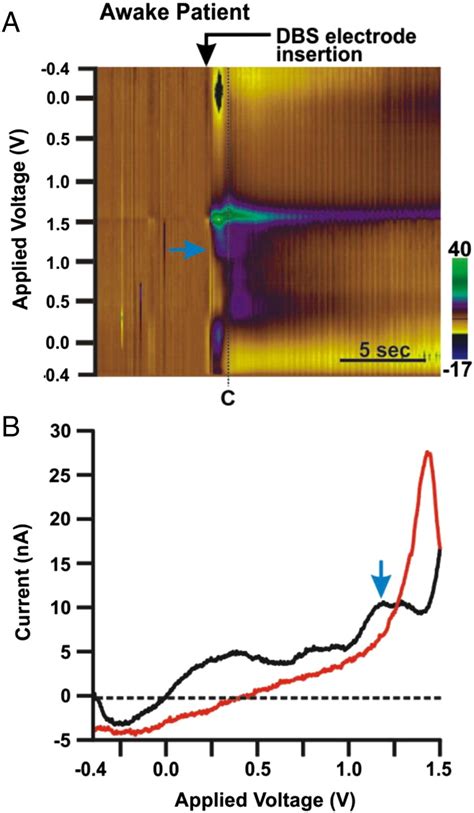 Fast Scan Cyclic Voltammetry For The Characterization Of Rapid Adenosine Release Computational