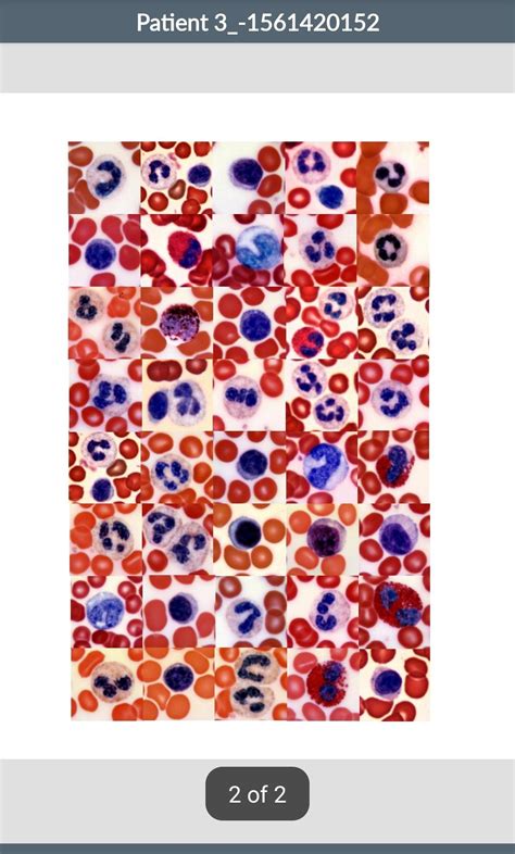 Solved Differential White Blood Cell Count You Will Be Chegg Com