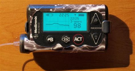 Jangeox Blog Dexcom Vs Medtronic