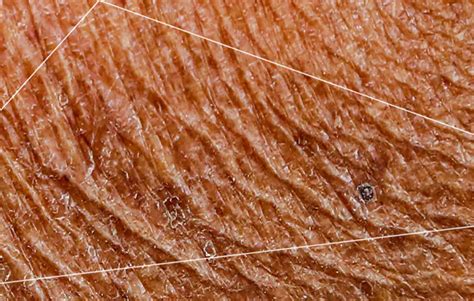 Cavilon No Sting Barrier Film - Medical Monks