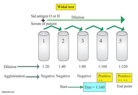 Widal Test Principle Procedure Result Advantages Limi