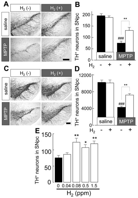 A Representative Photomicrographs Illustrating Tyrosine Hydroxylase