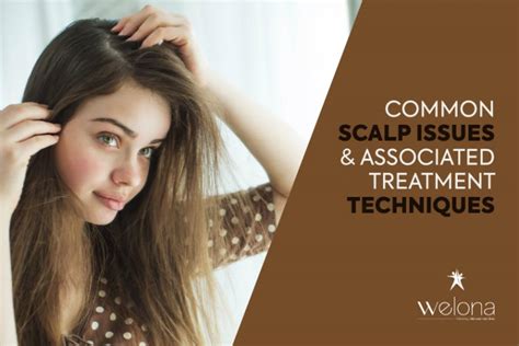 Common Scalp Issues And Associated Treatment Techniques