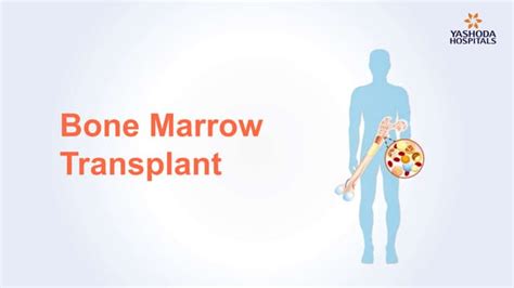 Bone Marrow Transplant In India Bone Marrow Transplantation In