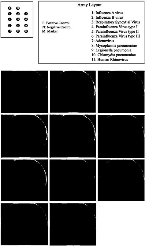 Primer Set For Respiratory Tract Infection Pathogen Detection Rapid Diagnostic Kit And