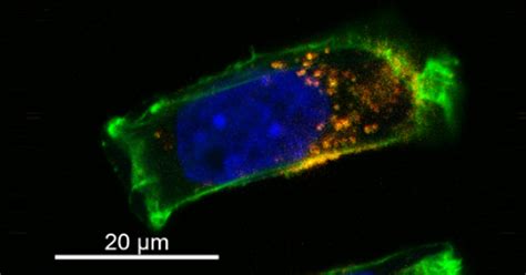 Novel Nanomedicines Udaily