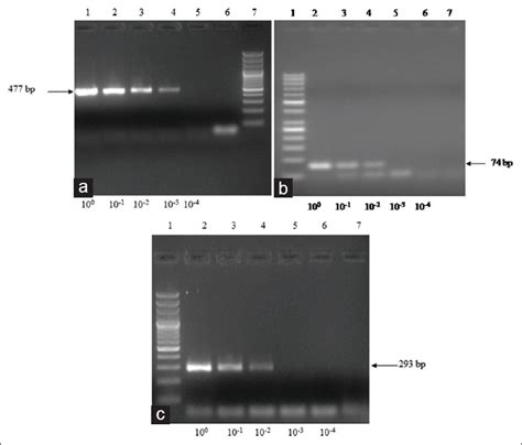 Multiplex Pcr Assay For Simultaneous Detection And Differentiation Of Entamoeba Histolytica