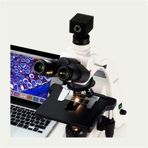 Sistema Medici N Espesor De Capas Semc