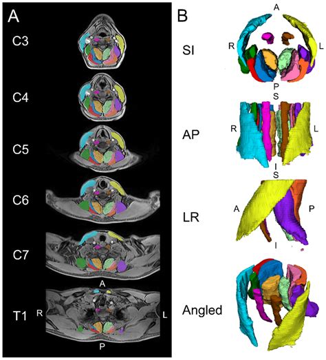 Example Images Are Shown For The Automated Segmentation Of The Cervical