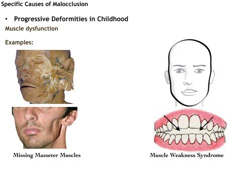 Known Causes Of Malocclusion Pdf