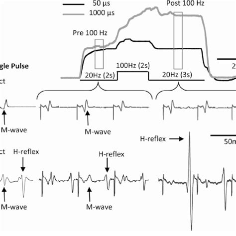 The Effect Of Pulse Duration And Pulse Frequency On The Central Download Scientific Diagram