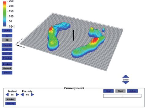 Figure 3 From Properties Of Tactile Sensors Based On Resistive Ink And The Dimension Of