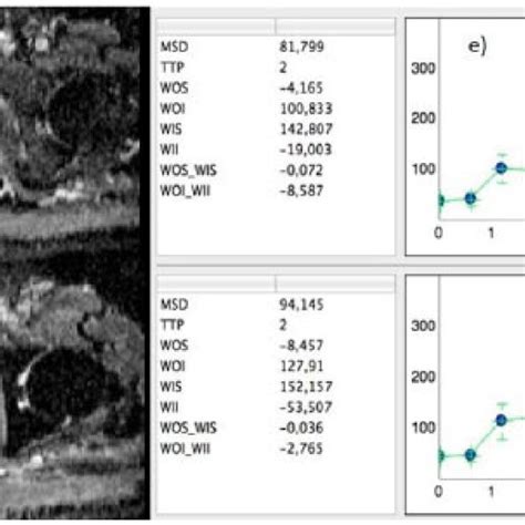 Dynamic Contrast Enhanced Magnetic Resonance Imaging And Standardized Download Scientific