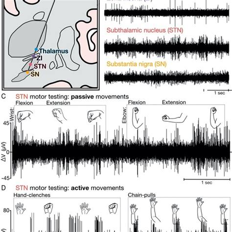 Microelectrode Motor Mapping A Atlas Schematic Of A Standard Download Scientific Diagram