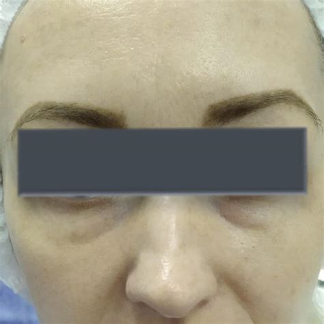 Косметолог Новосибирск Added A Косметолог Новосибирск