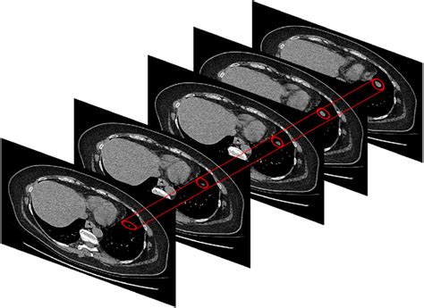 The Semi Automatic Segmentation Task For Extracting The Identified Download Scientific Diagram