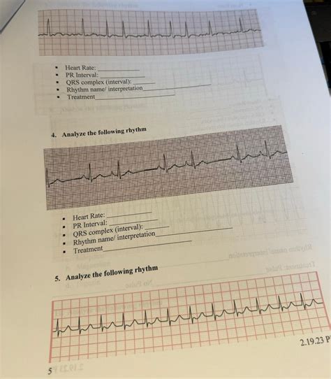 Solved Heart Rate PR Interval QRS Complex Interval Rhythm Chegg Com