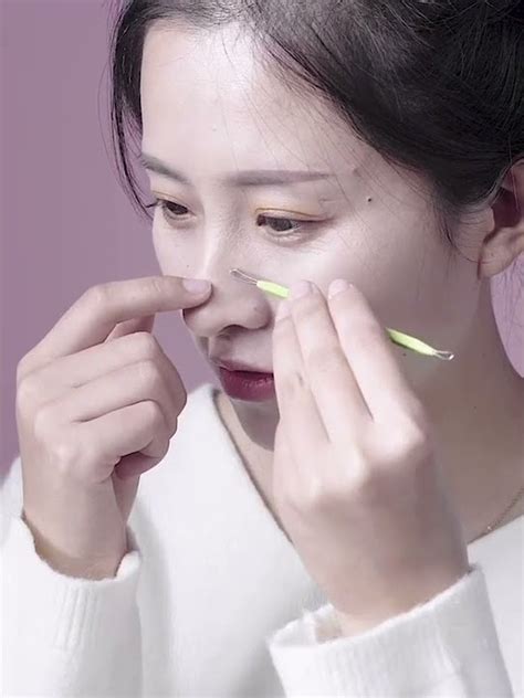여드름 압출기 피지뽑기 바늘 패치 전용집게 뷰티살롱 셀프흡입기 다이소 좁쌀여드름 상품링크는 고정댓글 확인 Youtube