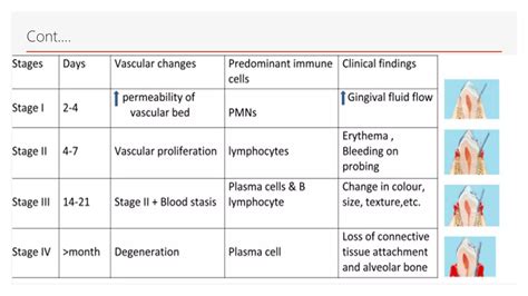 Gingivitis Or Gingival Inflammation Ppt