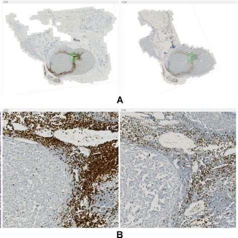 example result of the cell nucleus segmentation a cd3 raw image b