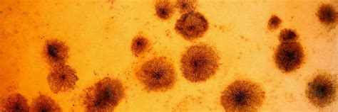 Microbes Under Microscope Background Images Hd Pictures And Wallpaper For Free Download Pngtree