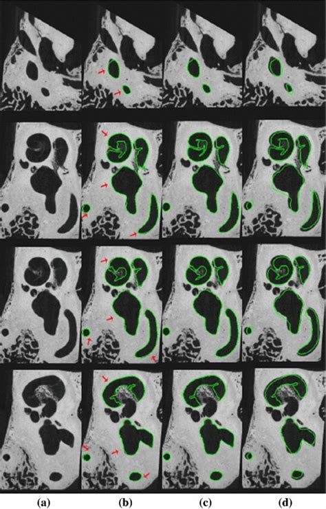 inner ear segmentation a original image b final segmentation arrows