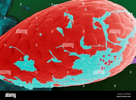 Under Moderate Magnification 2000X This Digitally Colorized Scanning