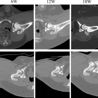 Example Sagittal And Coronal CT Images Of The Experimental Group And Download Scientific