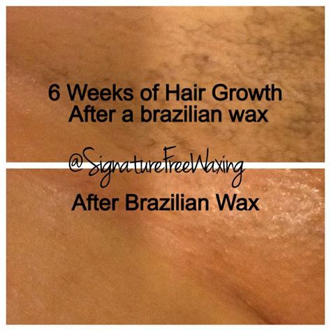 What Is An Extended Brazilian Wax