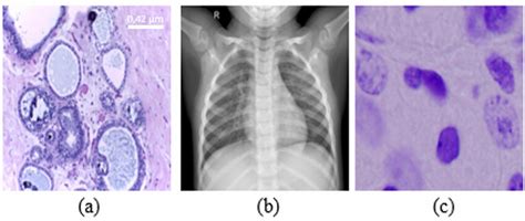 Examples From Datasets Were Used A Histopathology Scale Bar