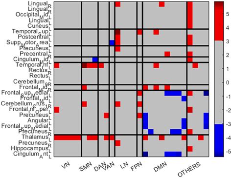 Abnormal Degree Centrality And Functional Connectivity In Down Syndrome