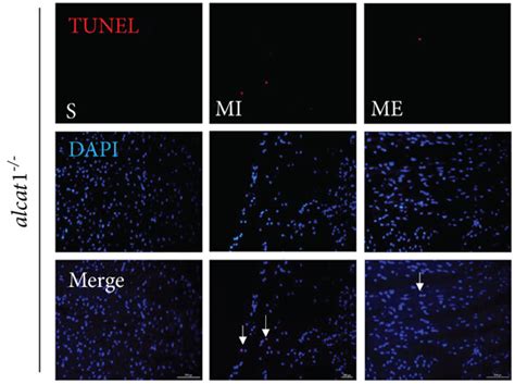 Aerobic Exercise And Knockout Alcat1 Reduced Cardiac Oxidative Stress Download Scientific