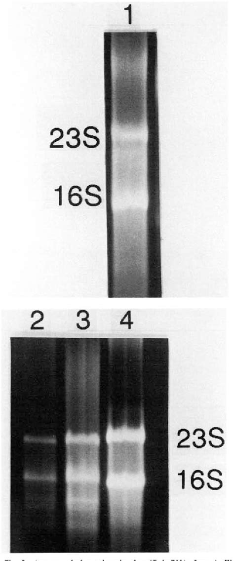 Figure 2 From Atypical Structure Of The 23s Ribosomal Rna Molecule In Certain Oral Bacteria