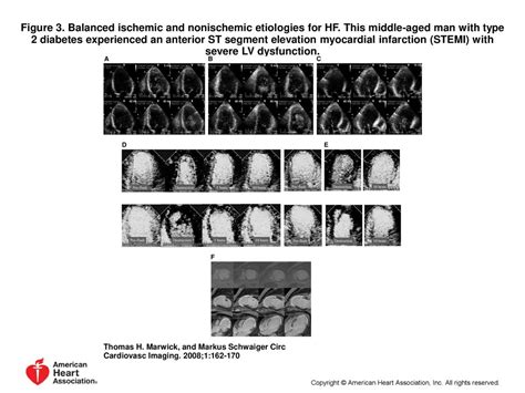 By Thomas H Marwick And Markus Schwaiger Circ Cardiovasc Imaging Ppt Download