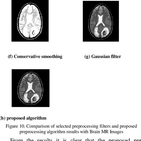 Figure 1 From An Optimized Preprocessing Decision For Multispectral Mri Based Applications