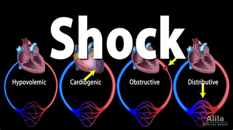 Introduction To Cardiogenic Shock Flashcards Quizlet