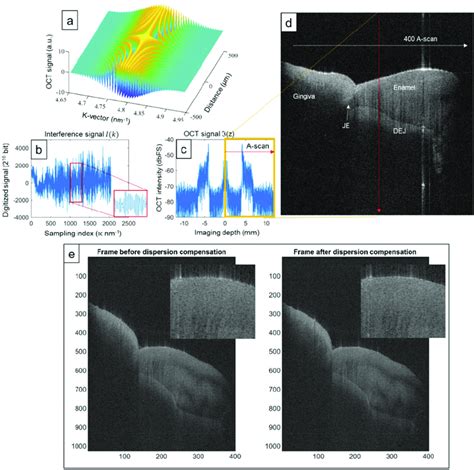 illustration of the interference signal and oct intensity signal in in