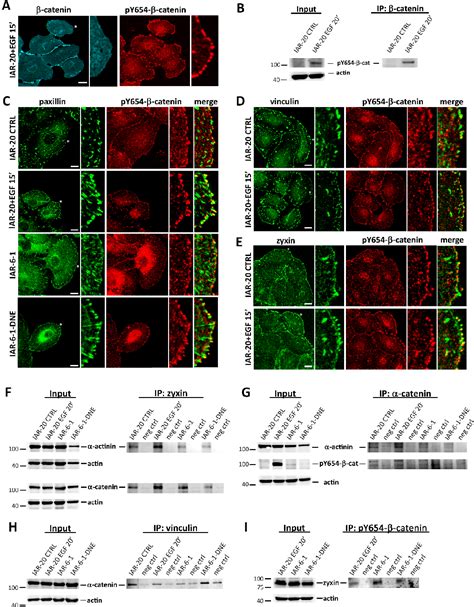 Figure 8 From Actin Cytoskeleton Remodeling Accompanied By