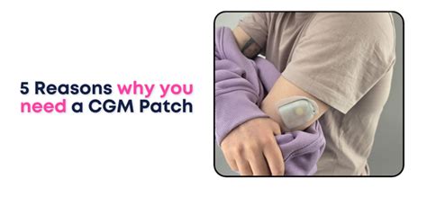 5 Key Reasons Why You Need A Cgm Patch Type One Style