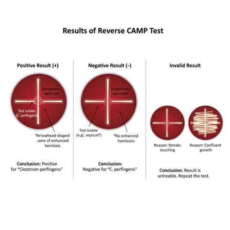 Reverse Camp Test Principle Procedure Result Uses Biology Notes