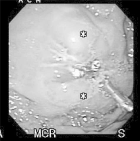C After Excision Of The Lesion Download Scientific Diagram