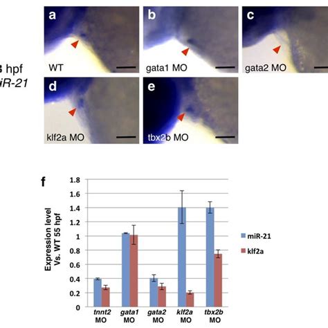 Figure S3 Histogram Of Error For The Gps Elevations Mean Error Of Download Scientific