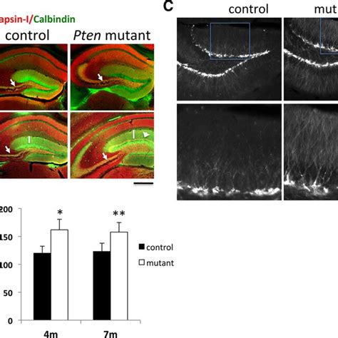 Dendritic And Axonal Hypertrophy And Ectopic Axonal Tracts In Pten