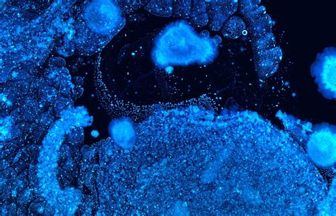 Ai Powered Gut Microbiome Profile Test Jona