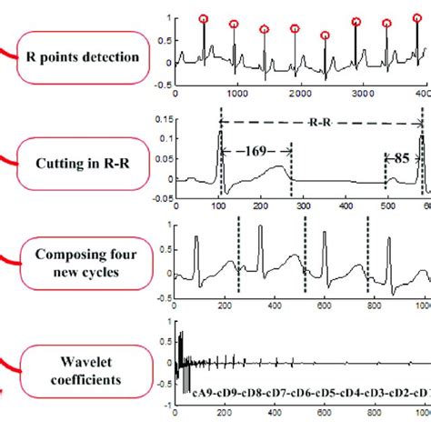 Process Of Wavelet Feature Extraction Download Scientific Diagram