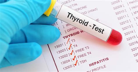 Thyroid Function Test
