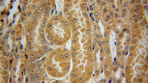 Inhibin Beta B Rabbit Polyclonal Antibody