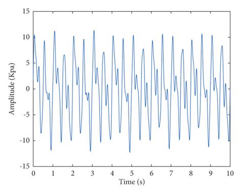 A Waveform Diagram And B Spectrogram After Lmd Pe Svd Noise Reduction Download Scientific